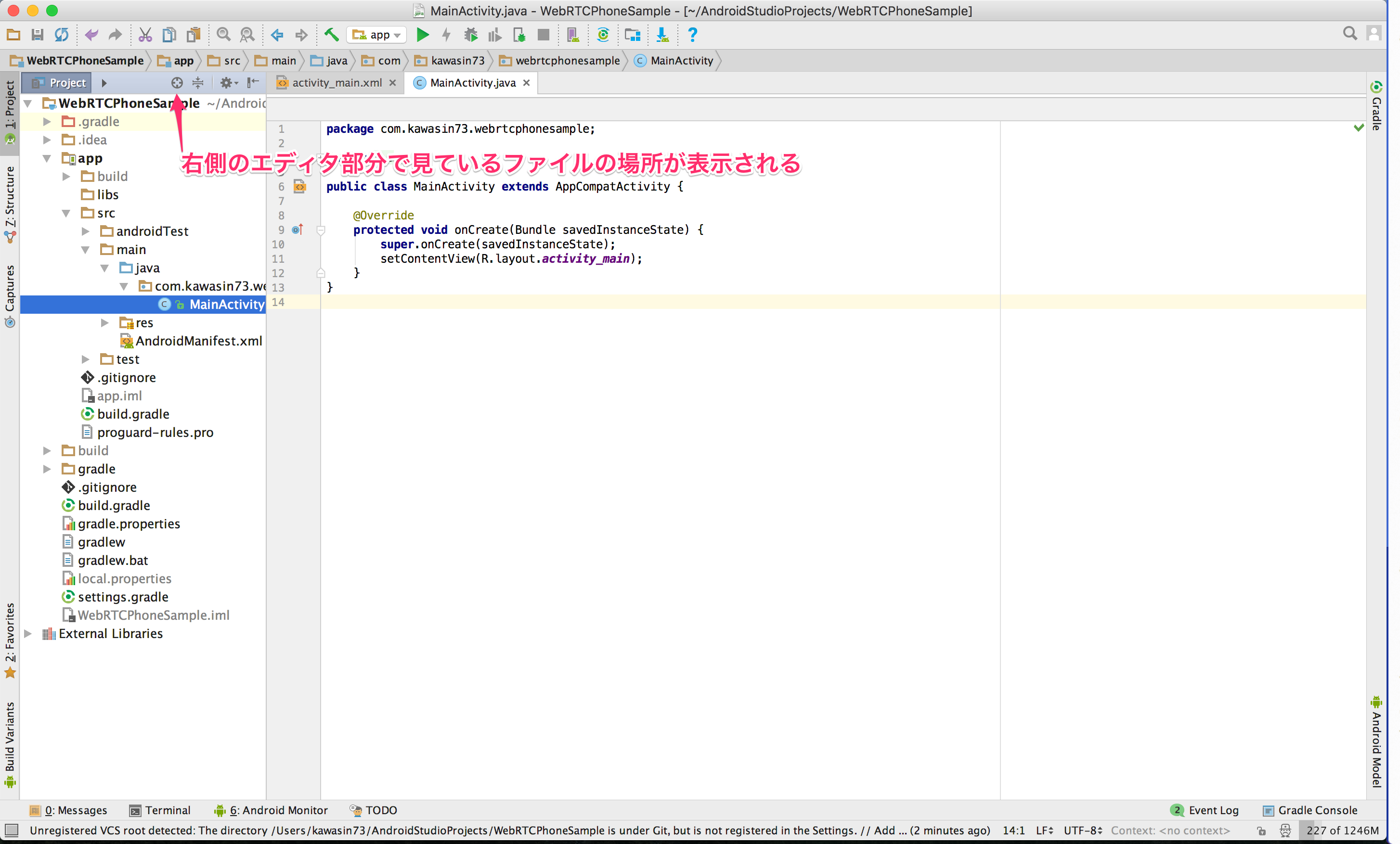AndroidでWebRTCを使った電話アプリを実装する【初心者向け】 #SkyWay - Qiita